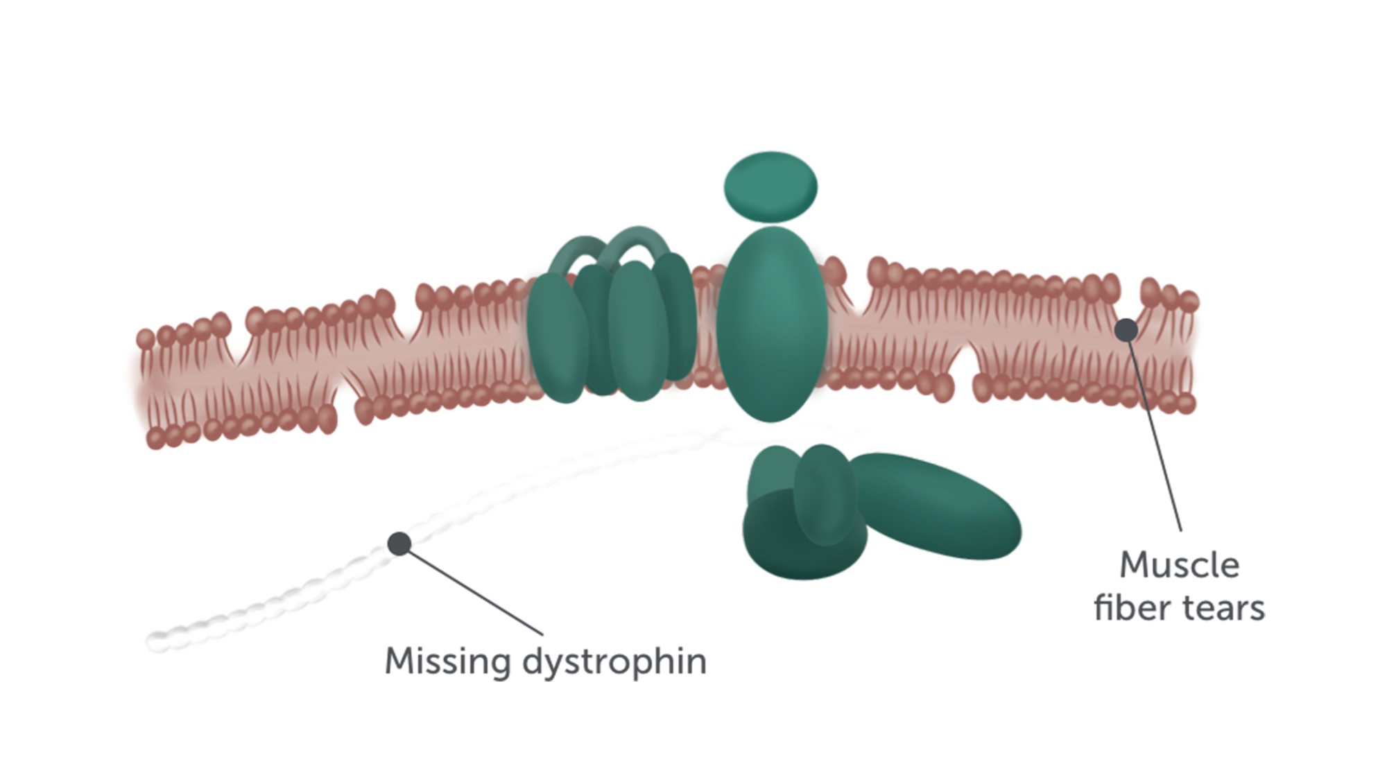 About Duchenne Muscular Dystrophy Dmd