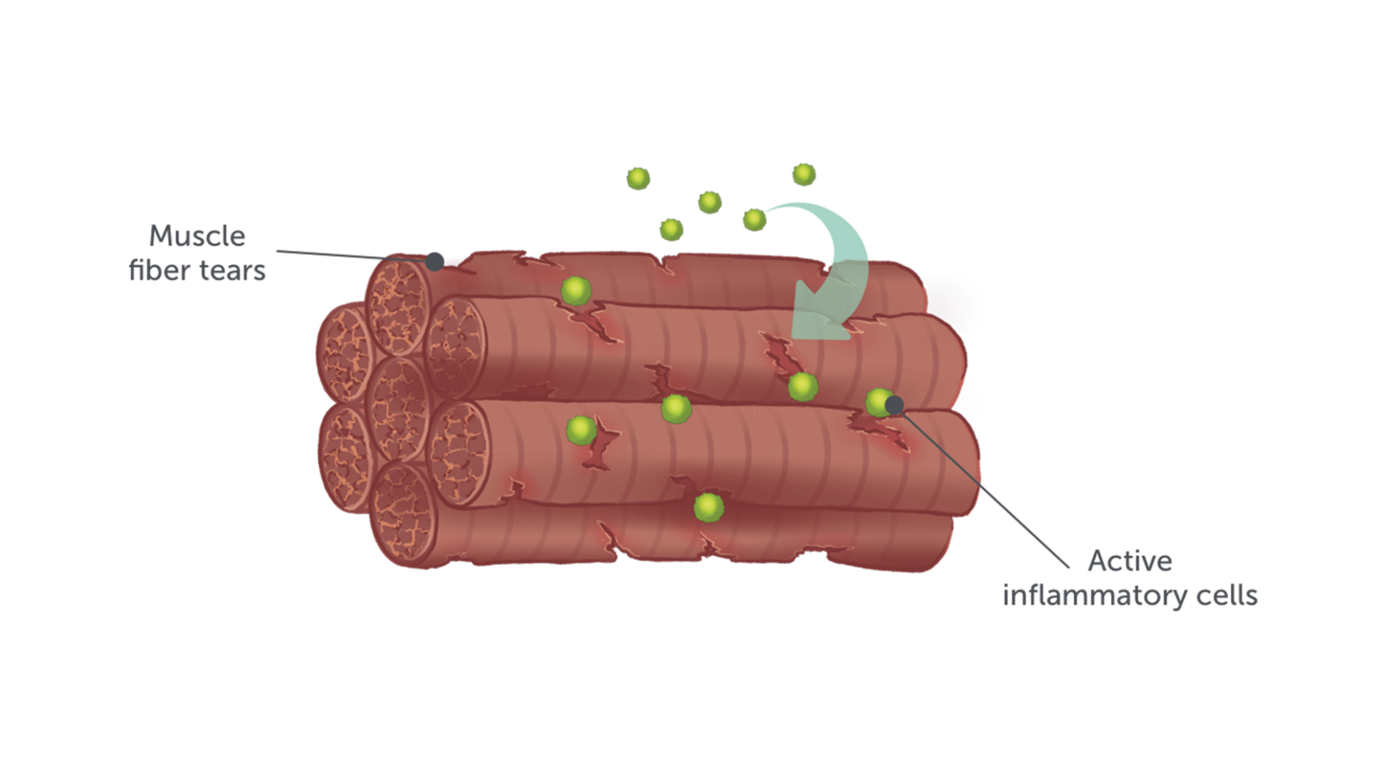 About Duchenne Muscular Dystrophy Dmd